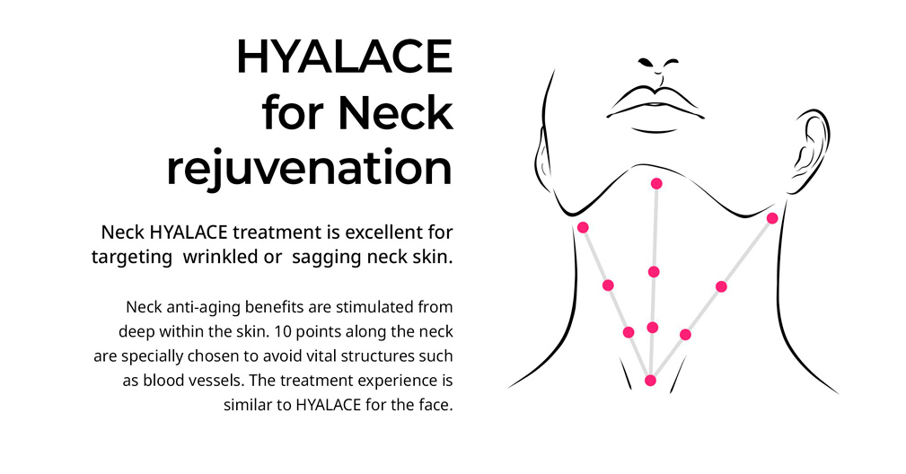 Hyalace Buy Online | Derma Solution