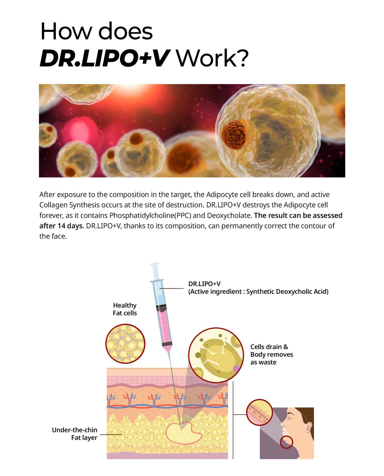 Dr. Lipo V-Face for Non-Surgical Facial Contouring | Derma Solution