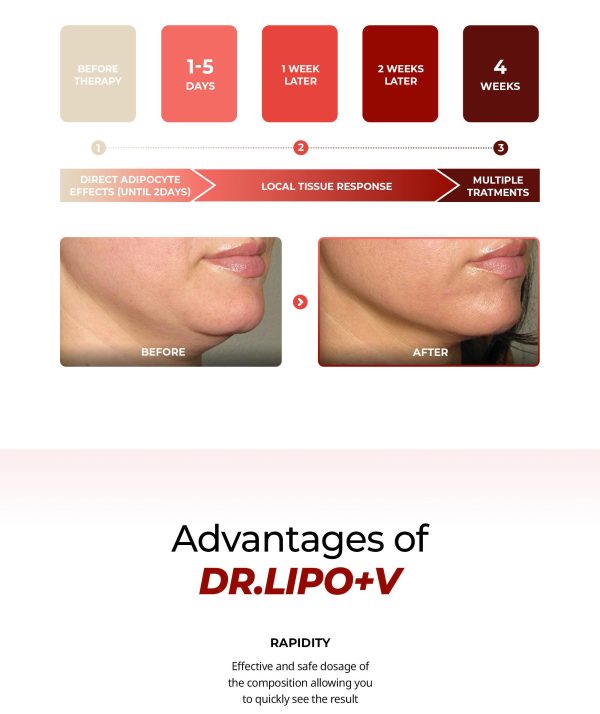Dr. Lipo V-Face for Non-Surgical Facial Contouring | Derma Solution