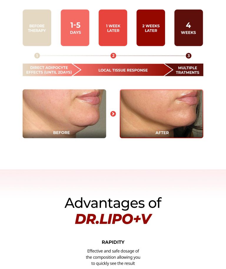 Dr. Lipo V-Face for Non-Surgical Facial Contouring | Derma Solution