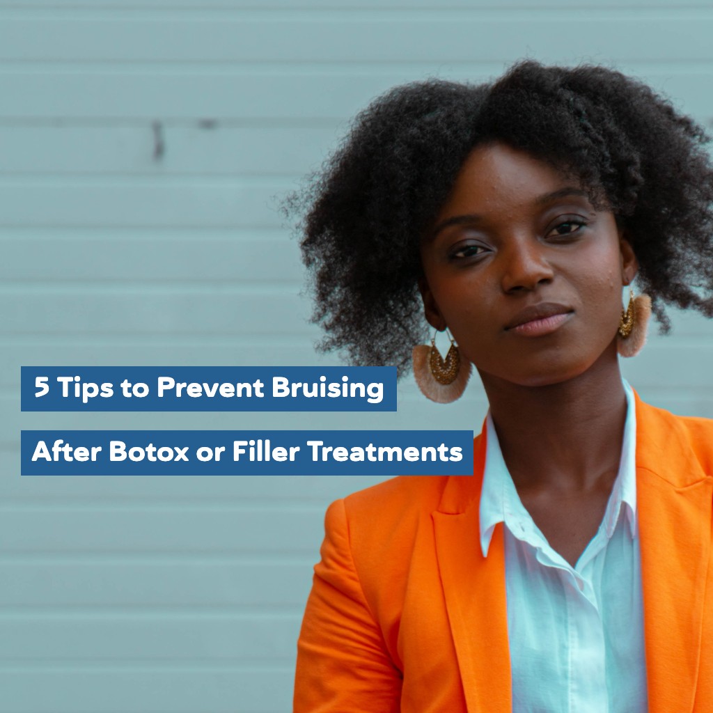 Bruising After Botox: How To Get Rid Of Bruises On Face From Injections ...