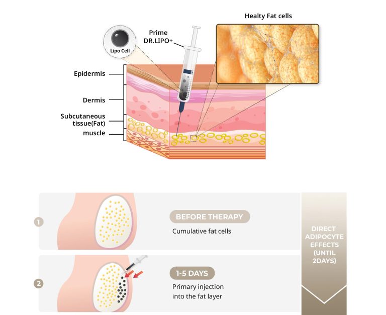 Prime Dr Lipo+ Buy Online | Derma Solution