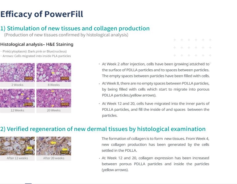 PowerFill – Buy Power Fill Filler Injection Online | Derma Solution