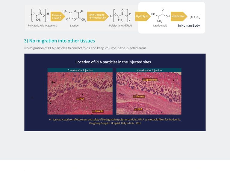 PowerFill – Buy Power Fill Filler Injection Online | Derma Solution