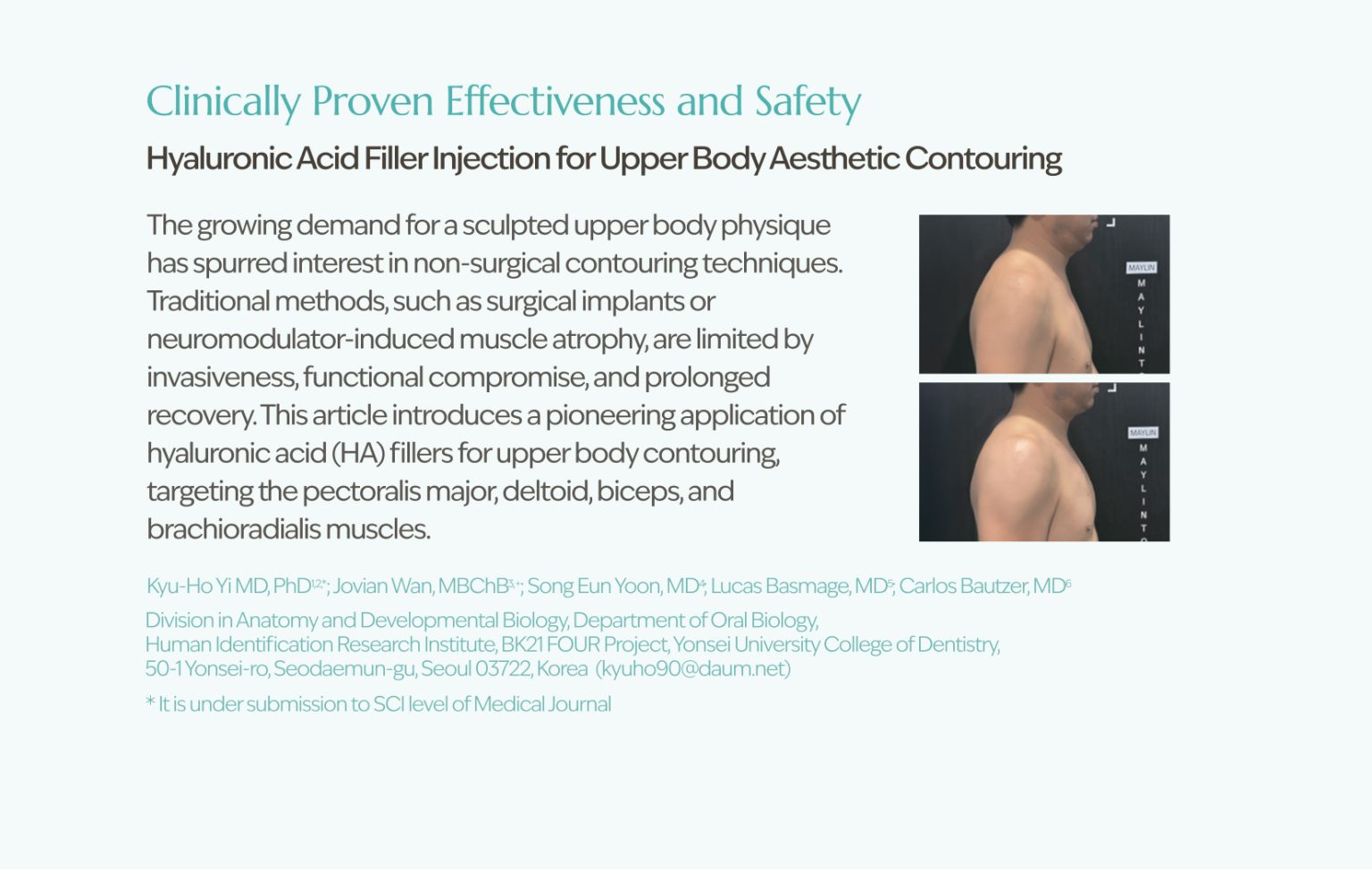 Buy Sedy Fill Body Filler 80ml Online | Derma Solution
